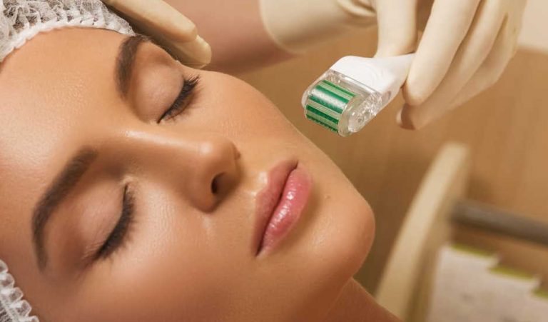 Which Is Better Microneedling Or Laser North American Odyssey